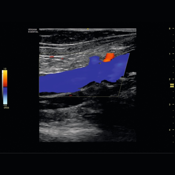 GE Versana Essential R2 - Medu Norge