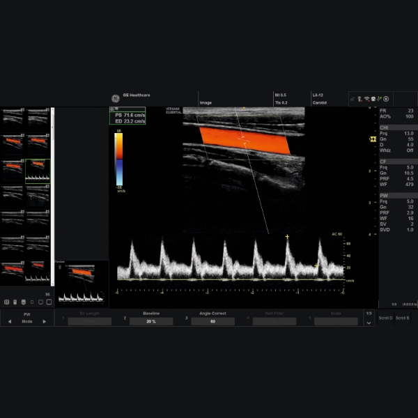 GE Versana Essential R2 - Medu Norge